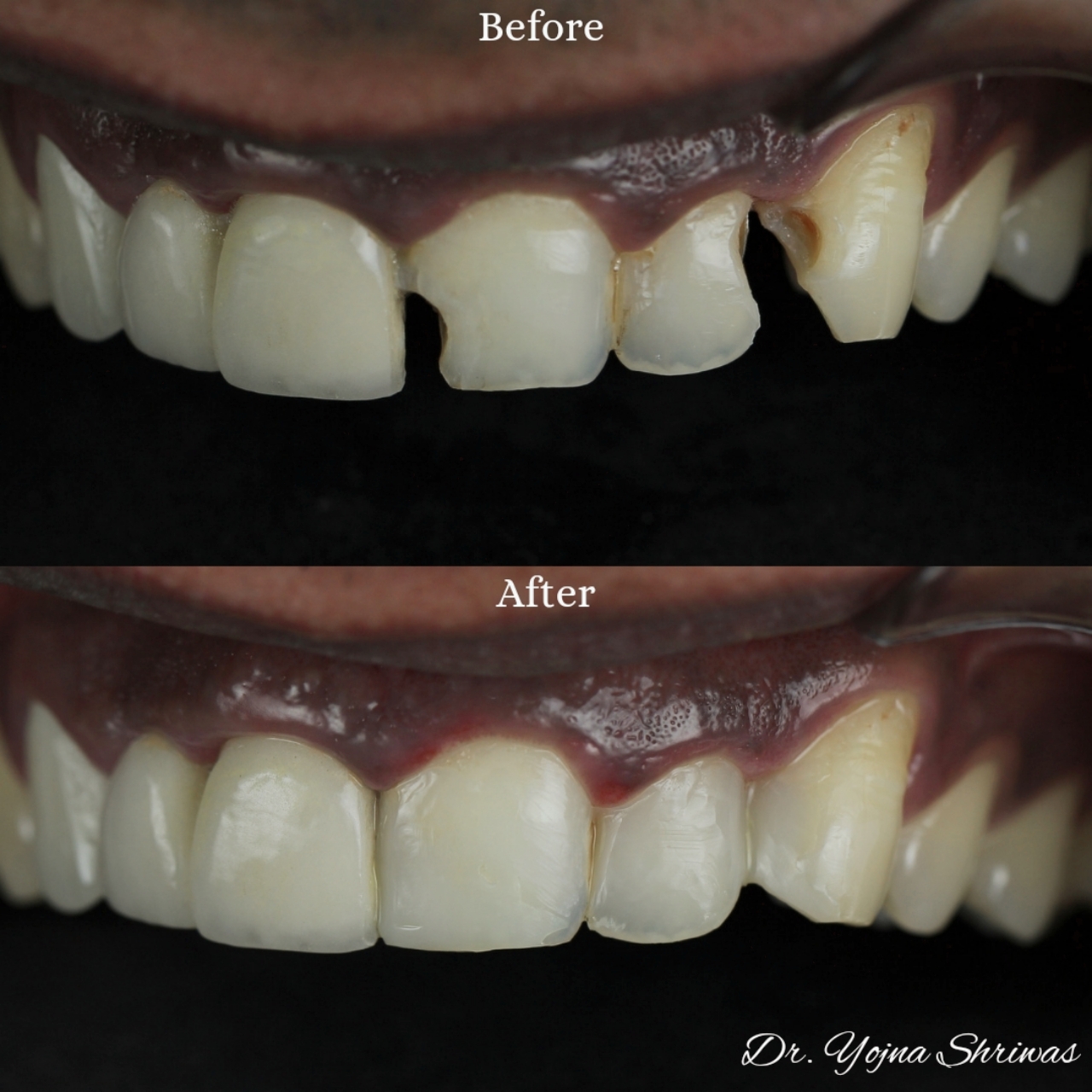 Dr Yojna's Dental Clinic » Restorative Dentistry